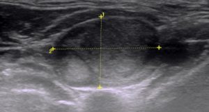 Lymph Nodes - Catherine Sinclair