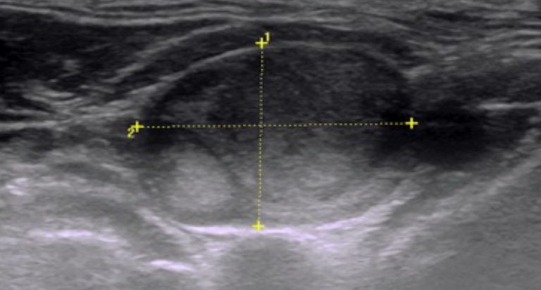 Lymph Nodes - Catherine Sinclair
