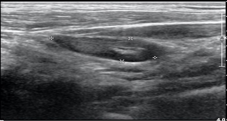 Lymph Nodes - Catherine Sinclair