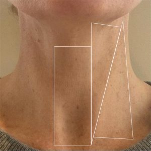 Lymph Nodes - Catherine Sinclair